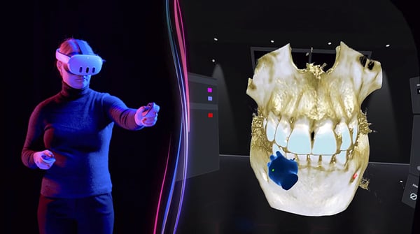 New software releases | Planmeca Romexis