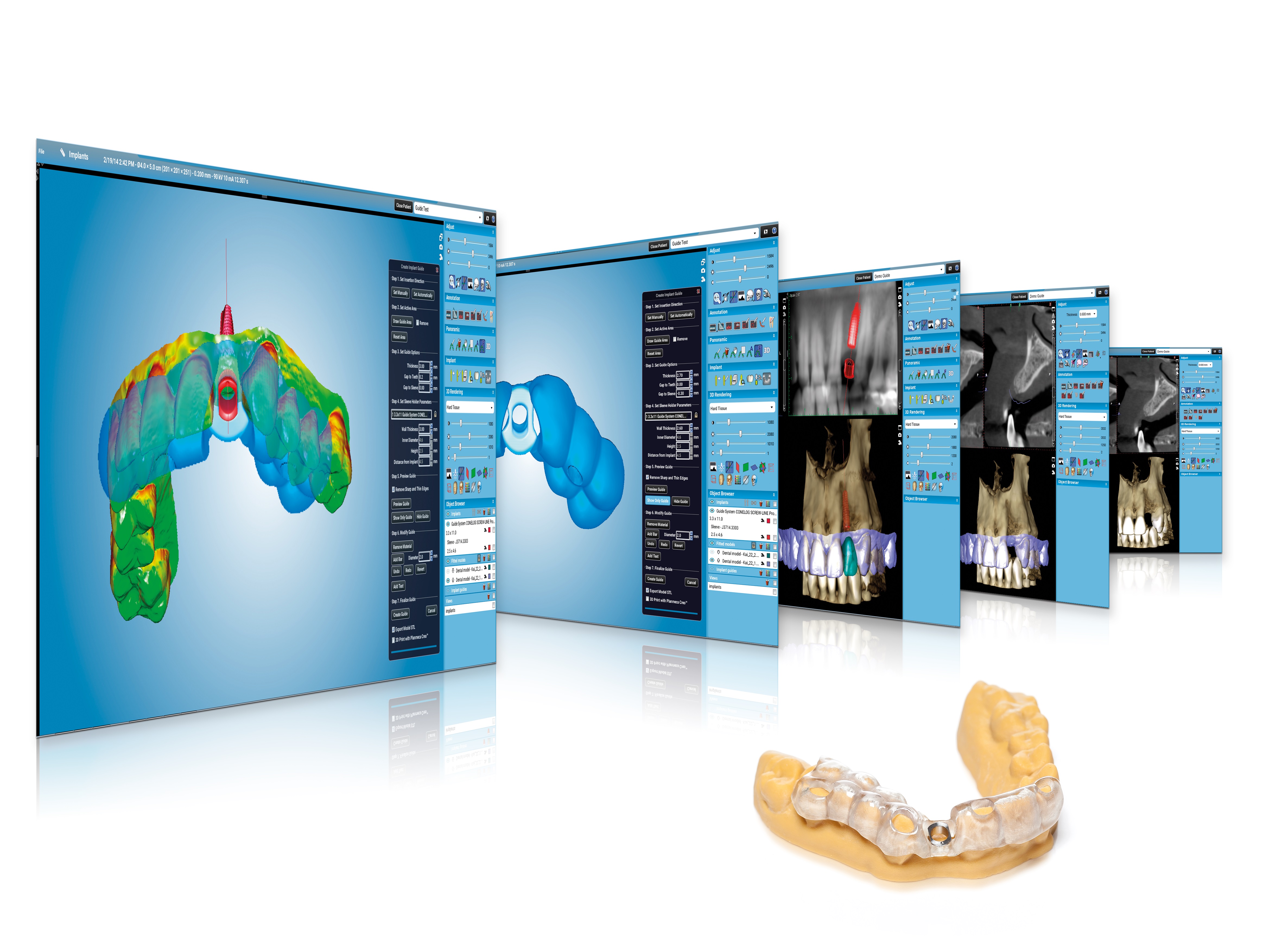 Planmeca’s surgical implant guide improves work flow; increases doctor ...