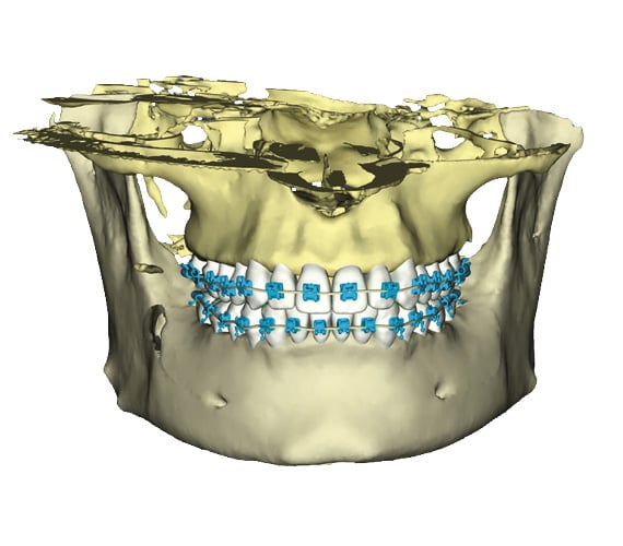 Planmeca ProMax 3D Mid – Extensive CBCT imaging