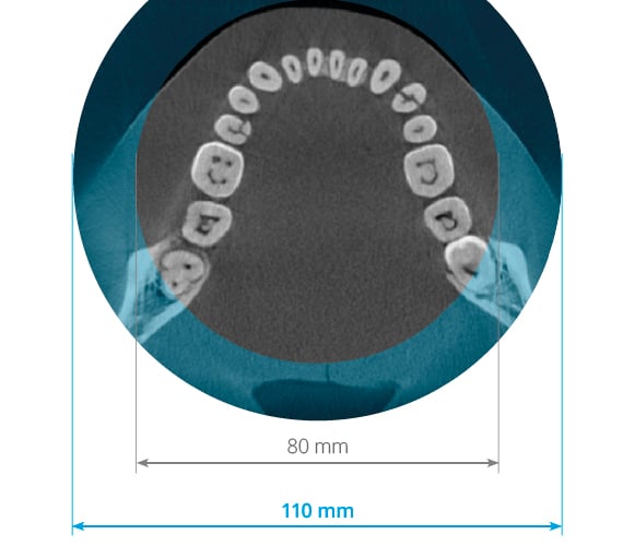 Planmeca ProMax 3D Classic – See the mandible and maxilla