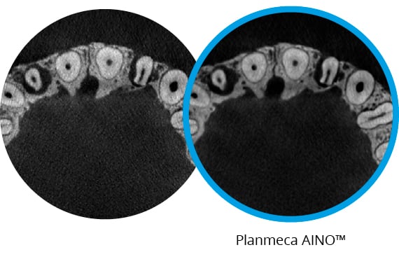 Premium CBCT image quality | Planmeca