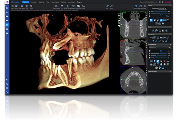 Premium CBCT image quality | Planmeca
