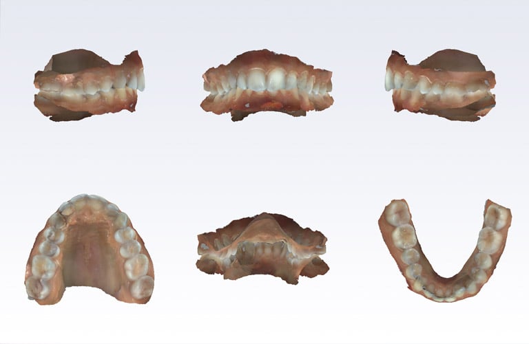 New software releases | Planmeca Romexis