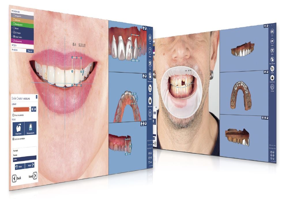 New software releases | Planmeca Romexis