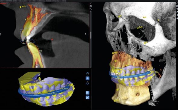 New software releases | Planmeca Romexis