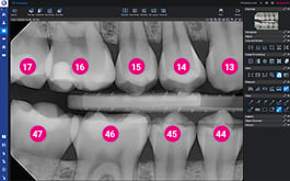 New software releases | Planmeca Romexis
