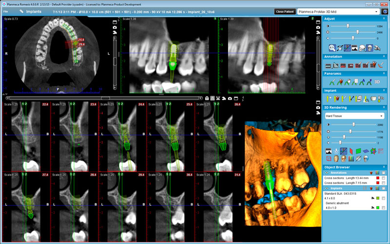Clinical images | Planmeca ProMax 3D Mid