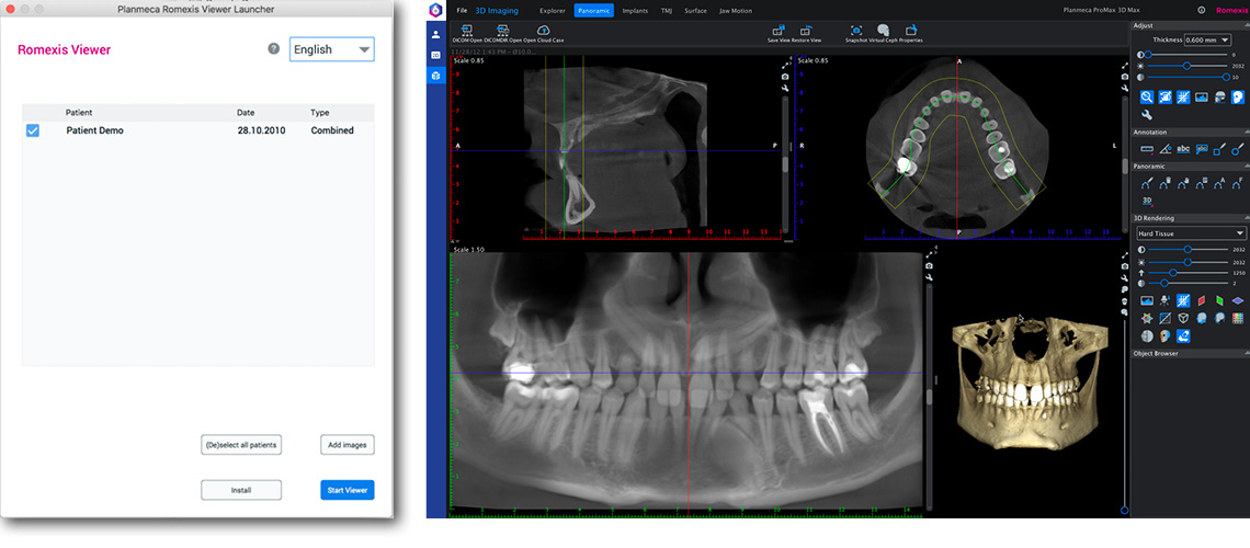 Romexis Configuration
