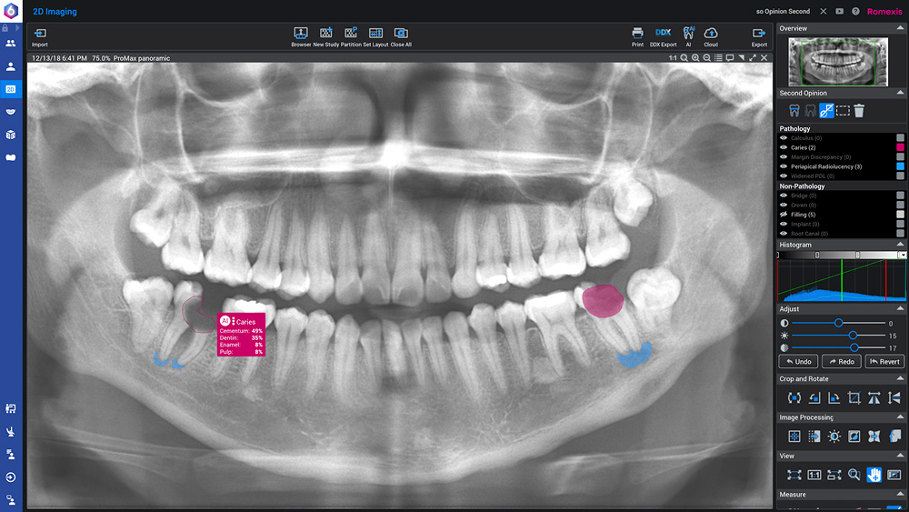 Romexis Configuration