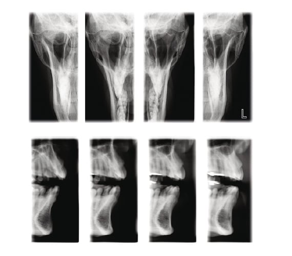 Planmeca 2D panoramic imaging