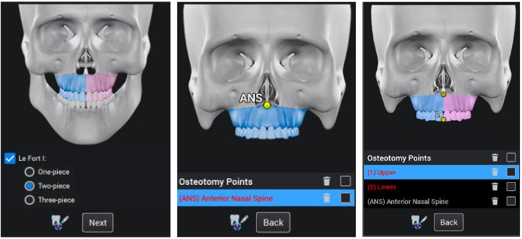 Romexis Configuration