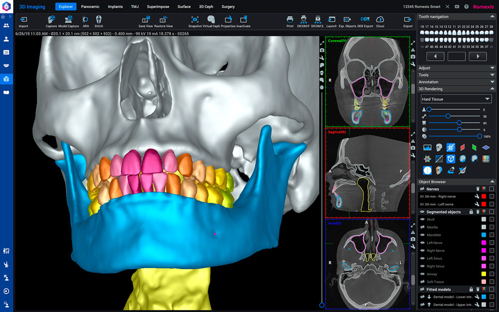 Romexis Configuration